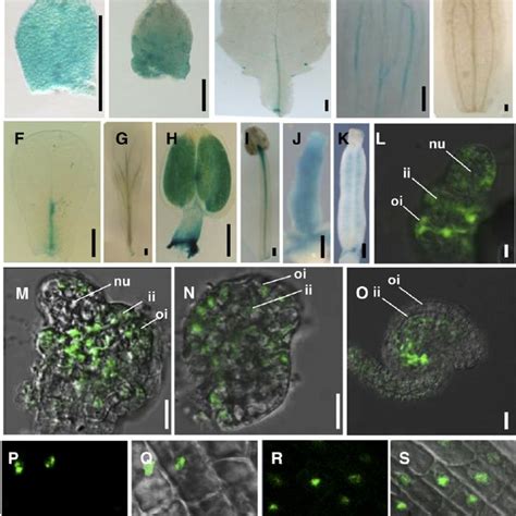 Expression Pattern And Subcellular Localization Of Sod7 Download