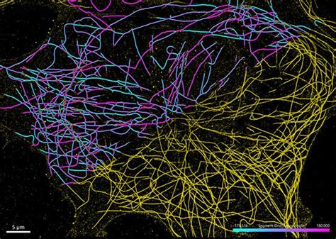 Imaris 100 Microscopy Image Analysis With Ai Filament Tracer Imaris Oxford Instruments