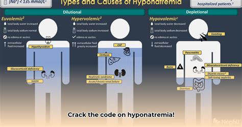 Master Hyponatremia Medical Coding A Cdi Specialists Guide Lifestyle And Productivity