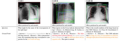 Gemex：一个用于胸部x光诊断的大规模、可溯源和可解释的医学vqa基准 知乎
