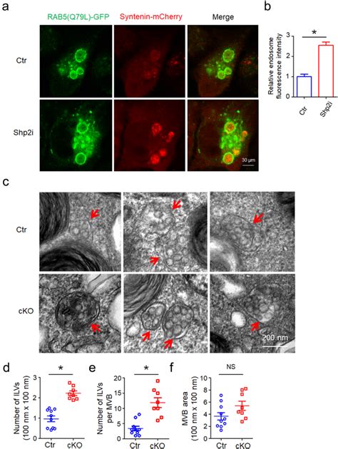 Increases In Number Of Intracellular Vesicles Ilvs By Shp2 Inhibition