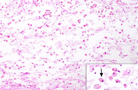 Histopathology Of The Telencephalic Cortex Of Sheep 8 Recovered From Histopathology Of The Telencephalic Cortex Of Sheep 8 Recovered From