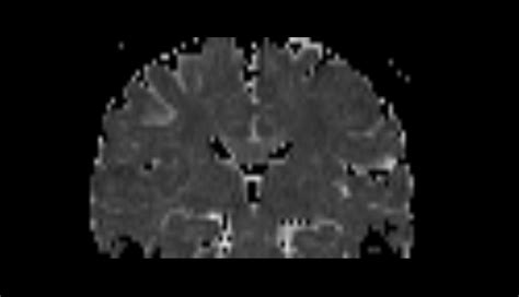 modules stochastictractography documentation 3 6 slicer wiki