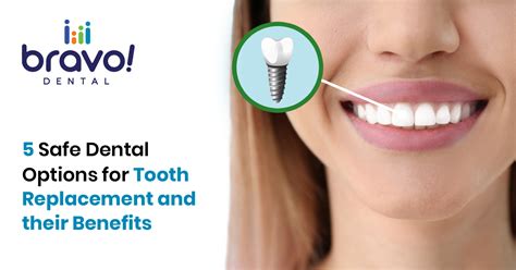 5 Safe Dental Options For Tooth Replacement And Their Benefits Bravo