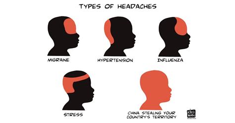 TYPES OF HEADACHES The Manila Times