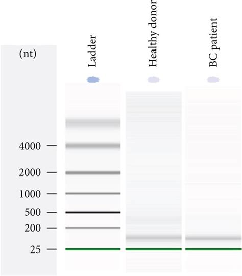 Quality Of Small Rna Isolated From Exosomes Representative Download Scientific Diagram