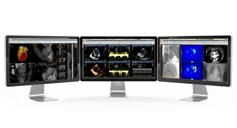 Shina Systems Medical Image Management And Advanced Visualization