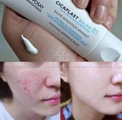 کرم ترمیم کننده سیکاپلاست لاروش پوزای بیوتی تجهیزات