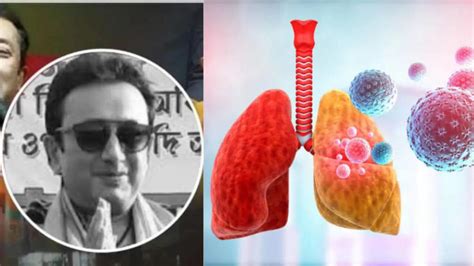 Joy Banerjee Dies Of Pneumonia At 62 How Seniors Can Prevent The Deadly Infection