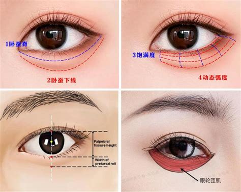 结构持久、动态自然、可逆调整：医用卧蚕支架引领眼部年轻化新趋势 知乎