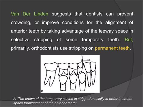 Interproximal Enamel Reduction Stripping Pptx