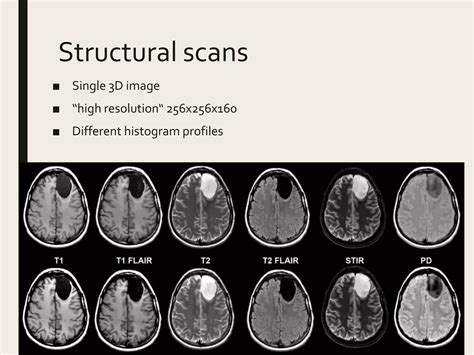 Ml Researchers Guide To Open Brain Imaging Data Ppt