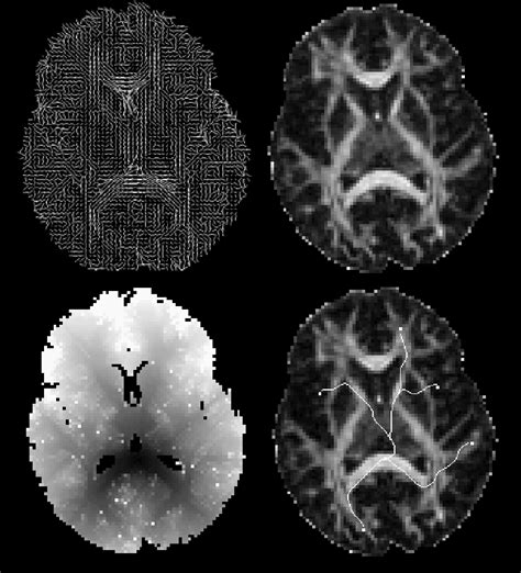 A Principal Eigenvectors Of The Diffusion Tensor 1 Modulated Download Scientific Diagram