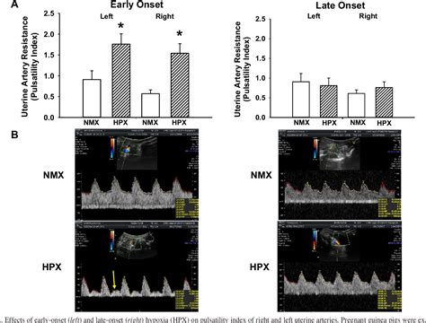 Figure 2 From Sex Differences And The Effects Of Intrauterine Hypoxia