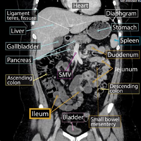 Gross Anatomy Glossary Small Intestine Ileum Imaging Ditki Medical