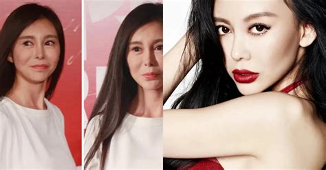 Bom Sex Củng Tân Lượng Khoe Thân Quá đà Biến Chứng Vì Thẩm Mỹ Sao Châu Á Việt Giải Trí