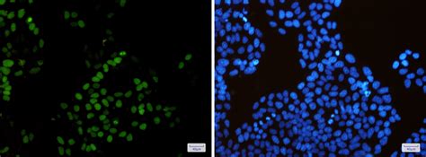 Kifc1 Rabbit Mab Sab Signalway Antibody