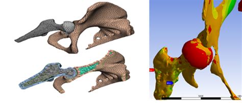 Application Of The Finite Element Model Using D Modeling Of A Human Bone System With