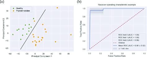 Linear Separability Of The Healthy Benign And Malignant Thyroid Nodus Download Scientific