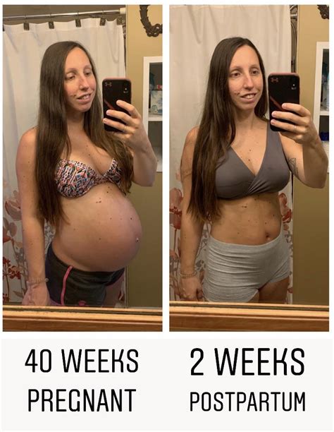 Before And After Pregnancy Belly Before And After Pregnancy Belly