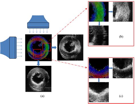 simulated ultrasound image from mr diffusion tensor image