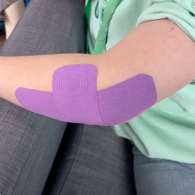 How To Use Physiotherapy Tape To Protect Tennis Elbow
