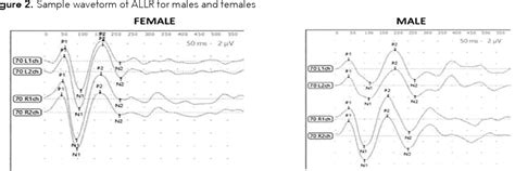 Figure 1 From Evaluation Of Auditory Late Latency Response In Older