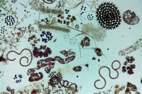 Chlorophyll A Limno Loan