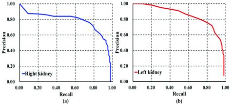 Precision Recall Curve Of Our Model On Subject Wise Testing A Right Download Scientific
