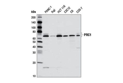 Prc1 Antibody Cell Signaling Technology