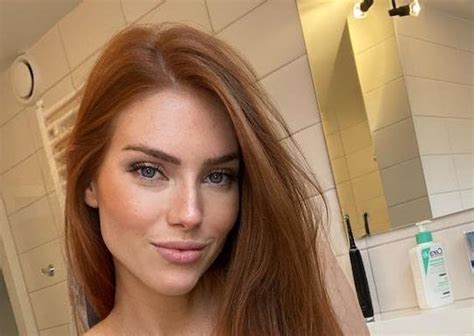 Girls With Freckles 35 Pics