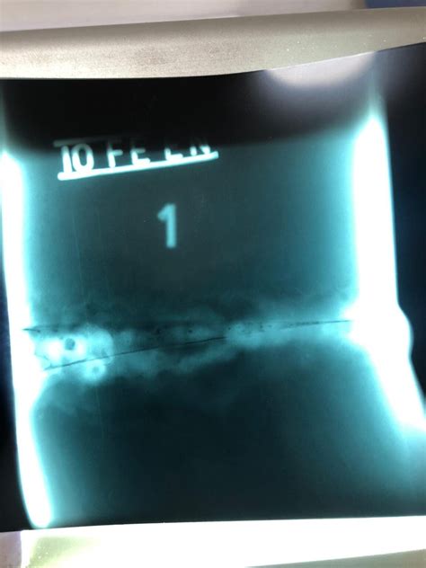 What Is NDT Non Destructive Testing And Inspection Methods NDT Inspect NDT Career And