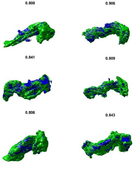 Surface Renderings Of Ground Truth Green And Cnn Segmentations Download Scientific Diagram