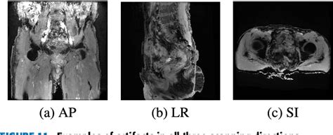 figure 11 from an unsupervised learning approach to 3d rectal mri