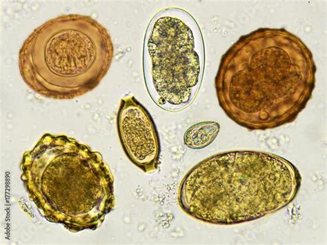 Parasites Object Detection Dataset And Pre Trained Model By Ahmad