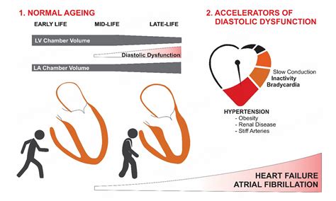 Aging Diastole Root Cause For Atrial Fibrillation And Heart Failure