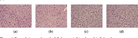 Figure 4 From Data Augmentation In Histopathological Classification An Analysis Exploring Gans