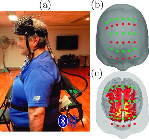 Near Infrared Spectroscopy Neuroimaging Device At Dennis Marquis Blog
