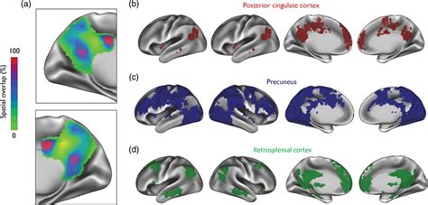 A Spatial Overlay Map Of Posteromedial Cortex Functional Subdivisions Download Scientific
