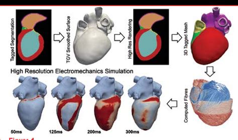 Figure 1 From A Personalised Approach To Computational Heart Modelling