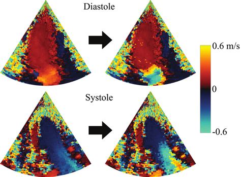 generation of synthetic images with artificial aliasing artifacts