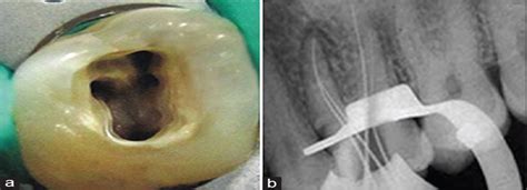 Contemporary Clinical Dentistry