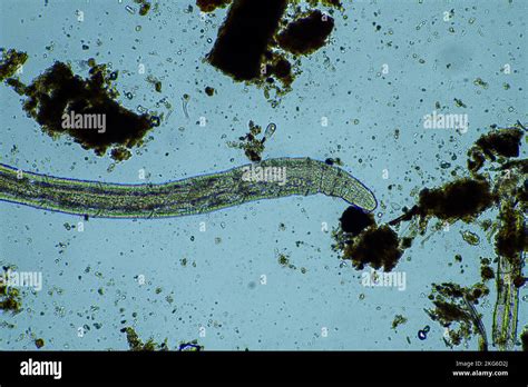 Human Parasite Gut Intestinal Infection Disease Microorganism