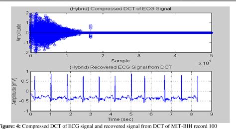 Figure 4 From Development Of Hybrid Lossless Ecg Signal Compression Technique By Concatenation