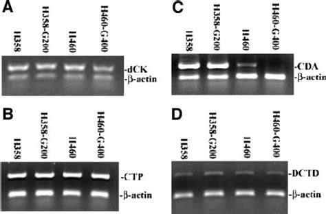 Semiquantitative Reverse Transcription Pcr Expression Analysis Of Dck Download Scientific