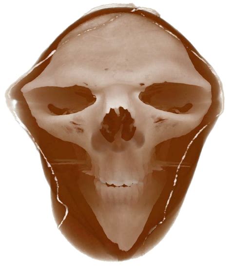 Direct Volume Rendering Of The Deformable Visible Human Data Set The Download Scientific