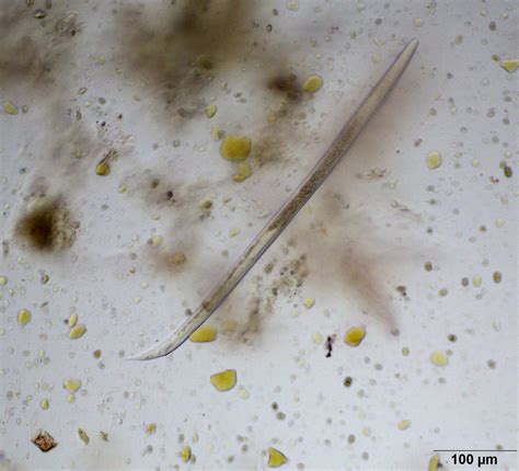 Roundworm Larvae Different Types Of Parasites You Should Be Aware Of