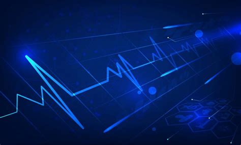 Cortex Biophysik Leverages Mcobjects Extremedb To Boost Cardiovascular Diagnostics For Athletes