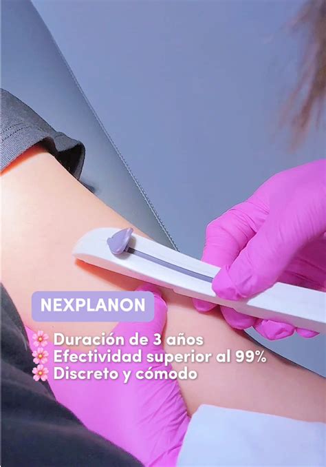 Nexplanon Eficacia Y Comodidad Del Implante Anticonceptivo Tiktok