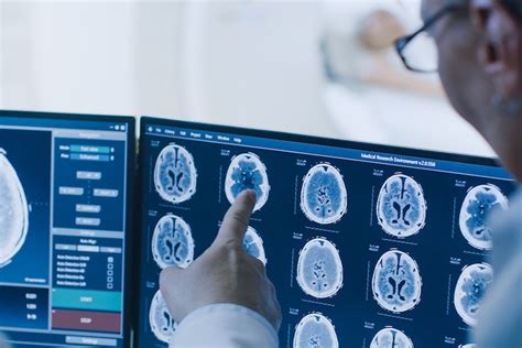 Neurology Services Florence Al